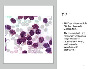 INTRODUCTION TO CHRONIC LEUKEMIA WHITE BLOOD CELLS MALIGNANCY | PPT