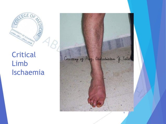 Chronic Limb Ischaemia.pdf