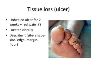 Chronic limb ischemia by Muhamad Fathy (MD) | PPTX