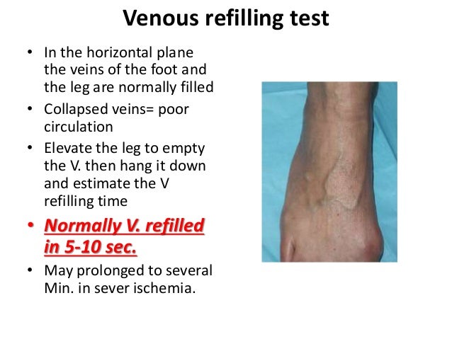 Chronic limb ischemia by Muhamad Fathy (MD)