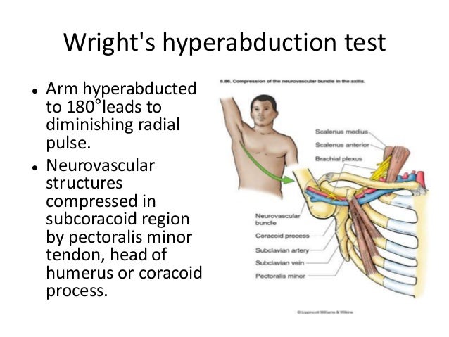 Chronic limb ischemia by Muhamad Fathy (MD)