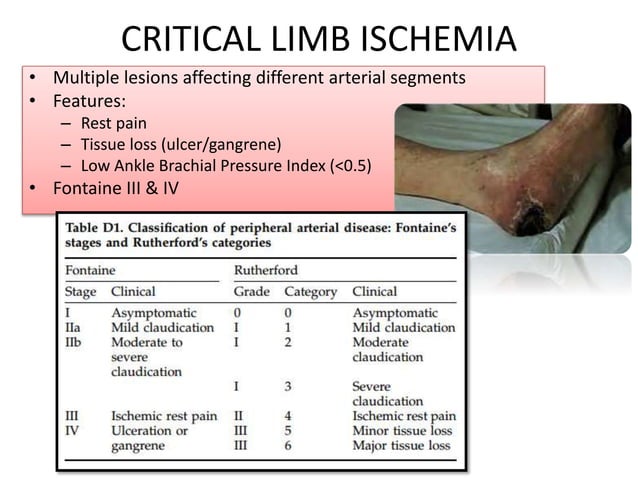 Chronic limb ischemia | PPTX | Diseases and Conditions | Medical Health