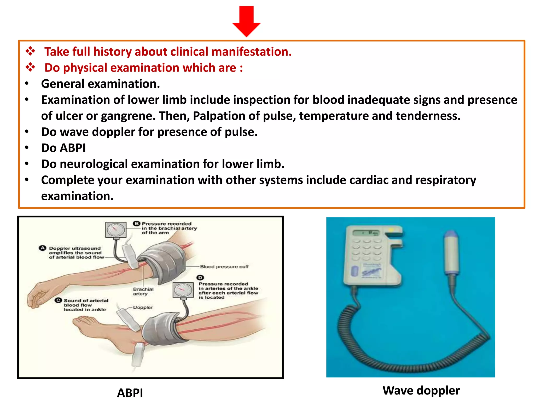 Chronic limb ischemia | PPTX