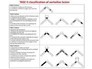 Chronic limb ischemia | PPTX | Foot Health | Diseases and Conditions