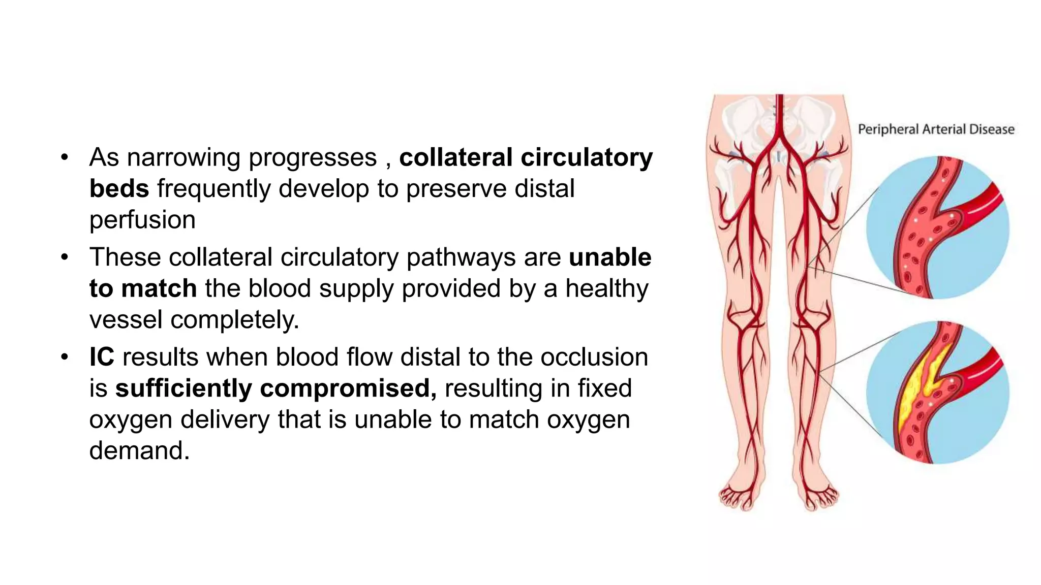 Peripheral Vascular disease / Chronic limb ischemia / CLI / Acute limb ...