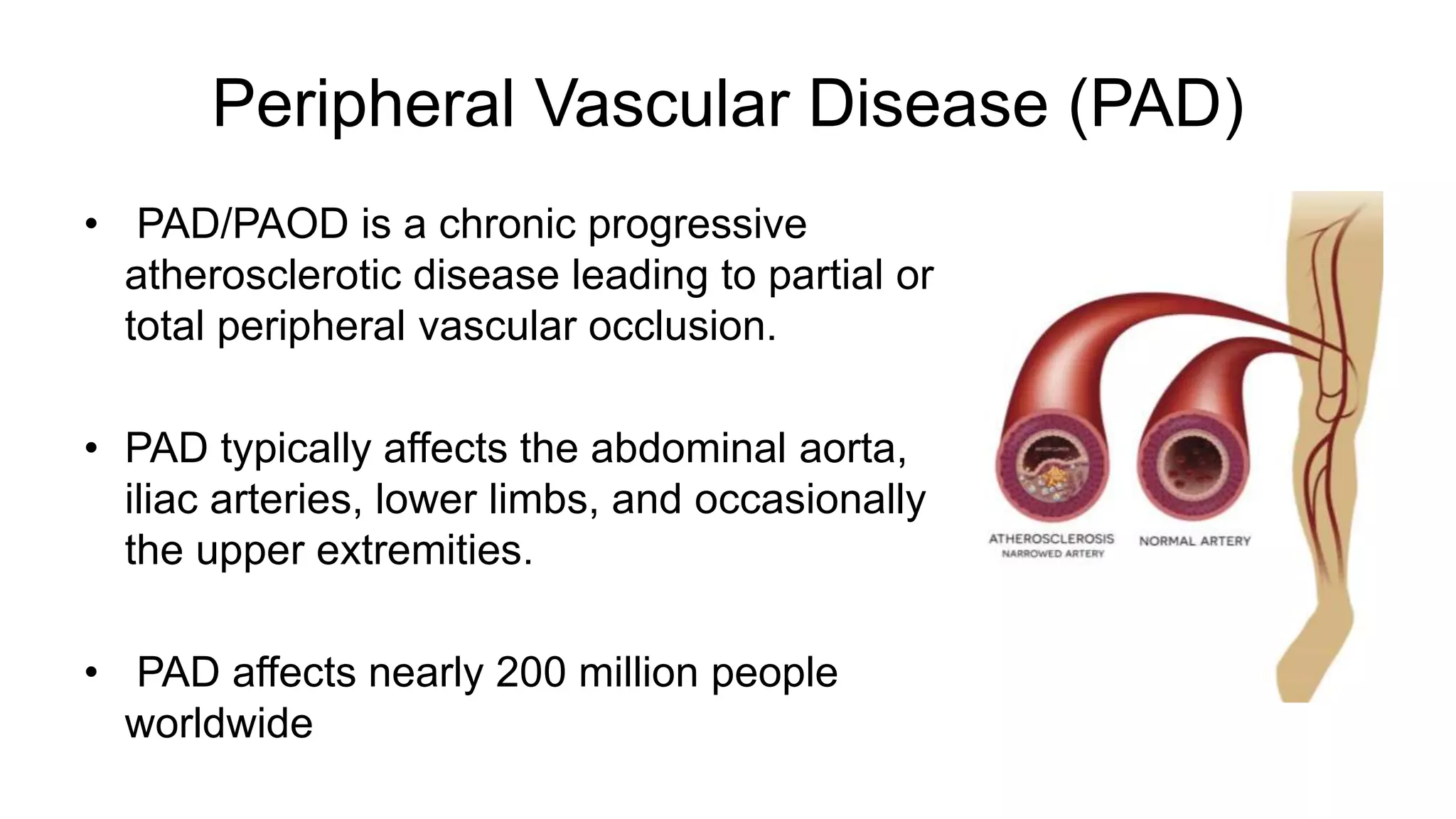 Peripheral Vascular disease / Chronic limb ischemia / CLI / Acute limb ...