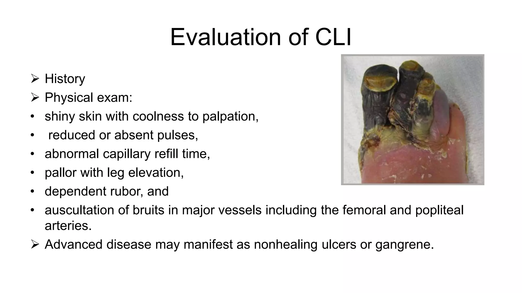 Peripheral Vascular disease / Chronic limb ischemia / CLI / Acute limb ...