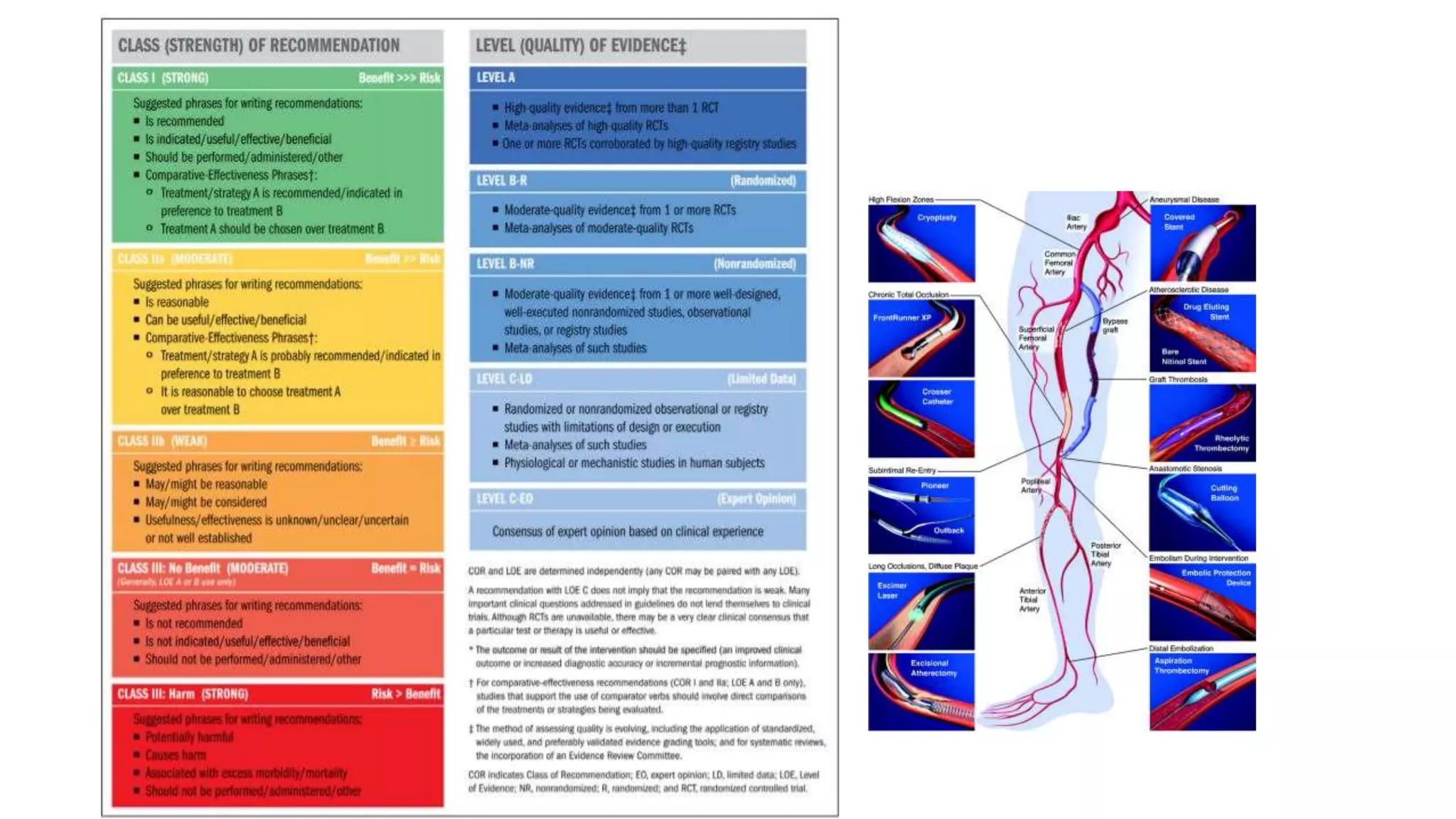 Peripheral Vascular disease / Chronic limb ischemia / CLI / Acute limb ...