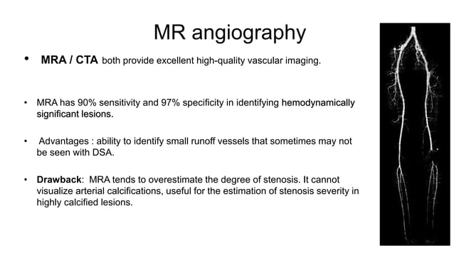 Peripheral Vascular disease / Chronic limb ischemia / CLI / Acute limb ...