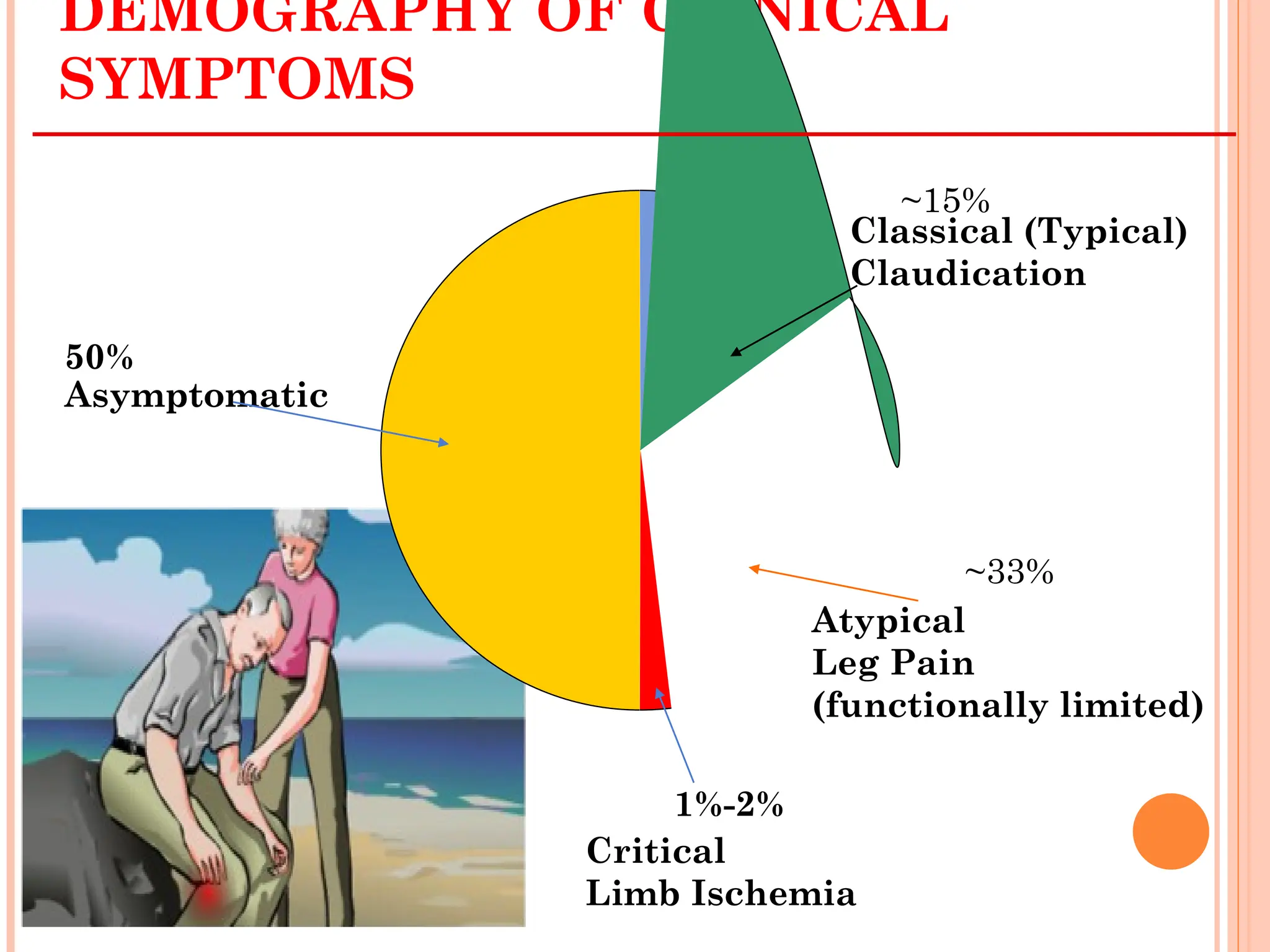 chroniclimbischemianew-copy-160423180154.ppt