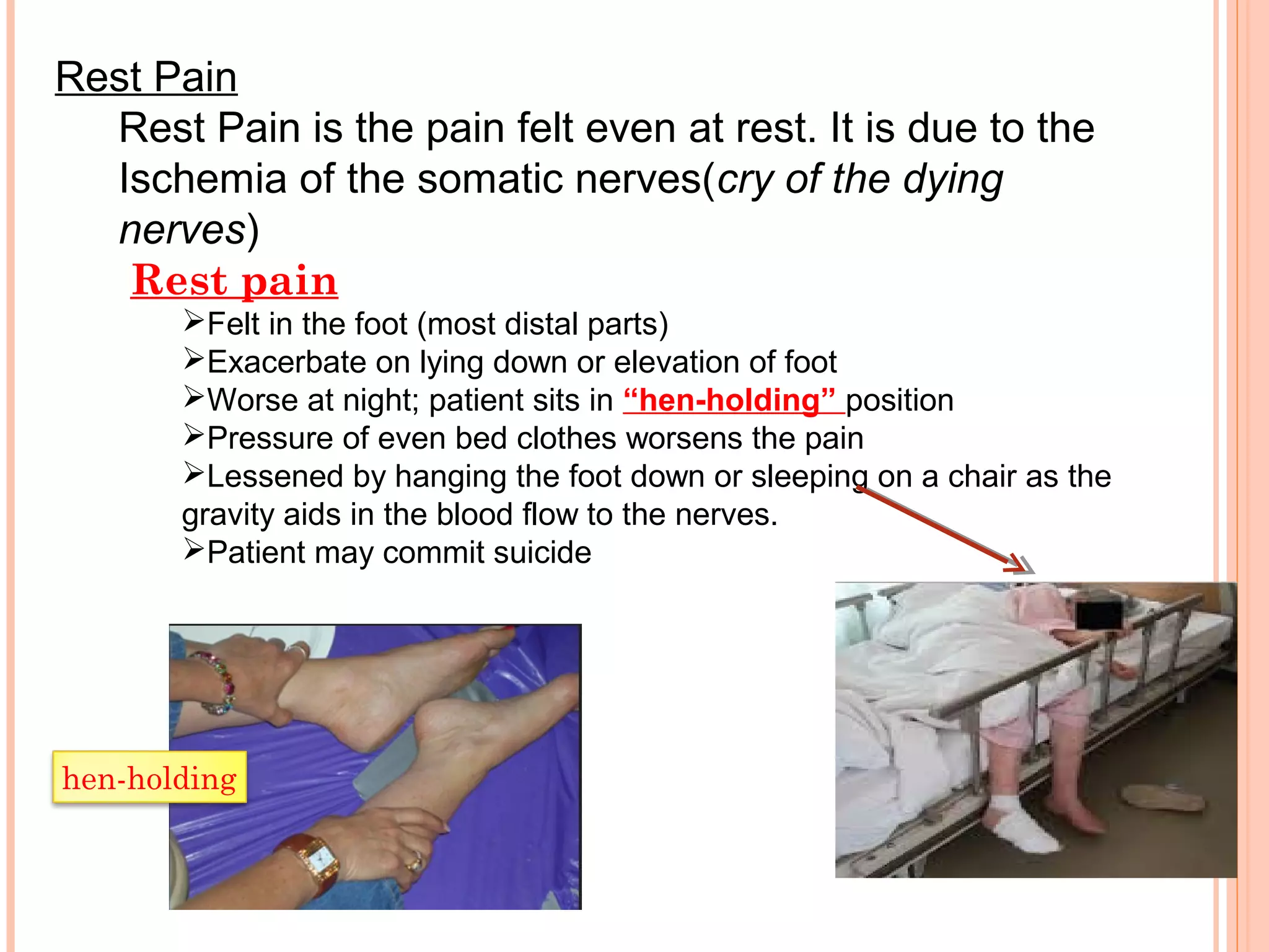Chronic limb ischemia | PPT