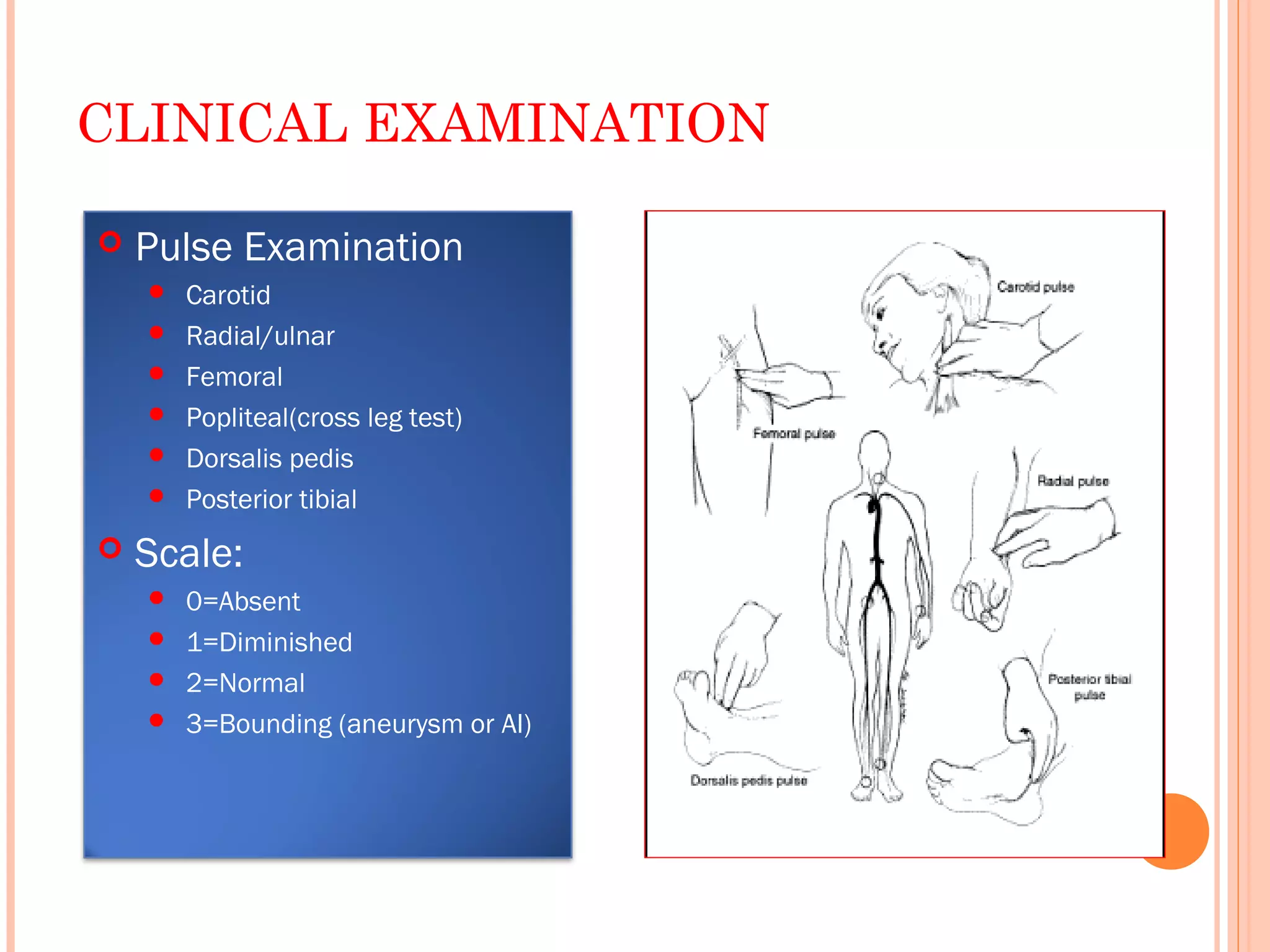 Chronic limb ischemia | PPT