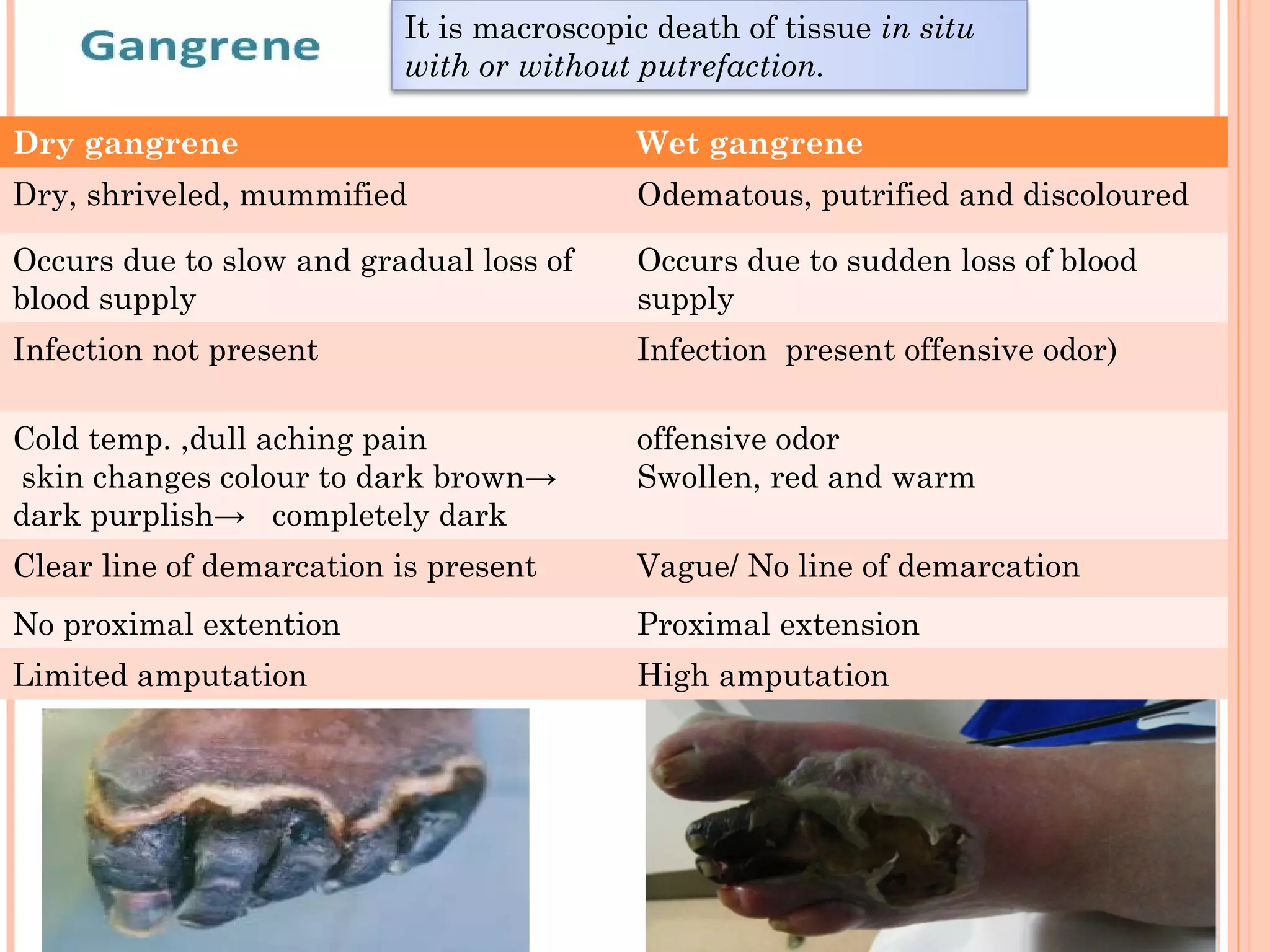 Chronic limb ischemia | PPT