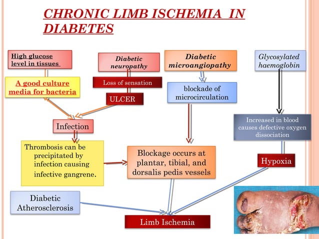 Chronic limb ischemia | PPT | Blood Disorders | Diseases and Conditions