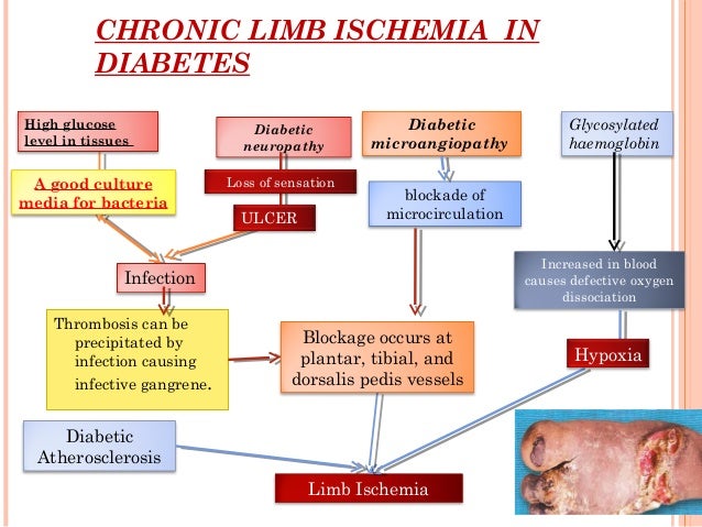 Chronic limb ischemia