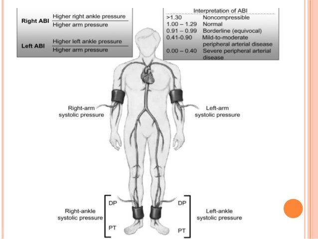Chronic limb ischemia