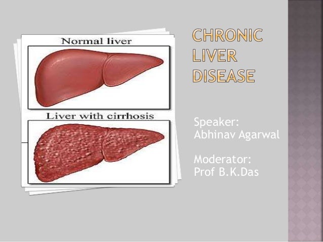 Chronic liver disease