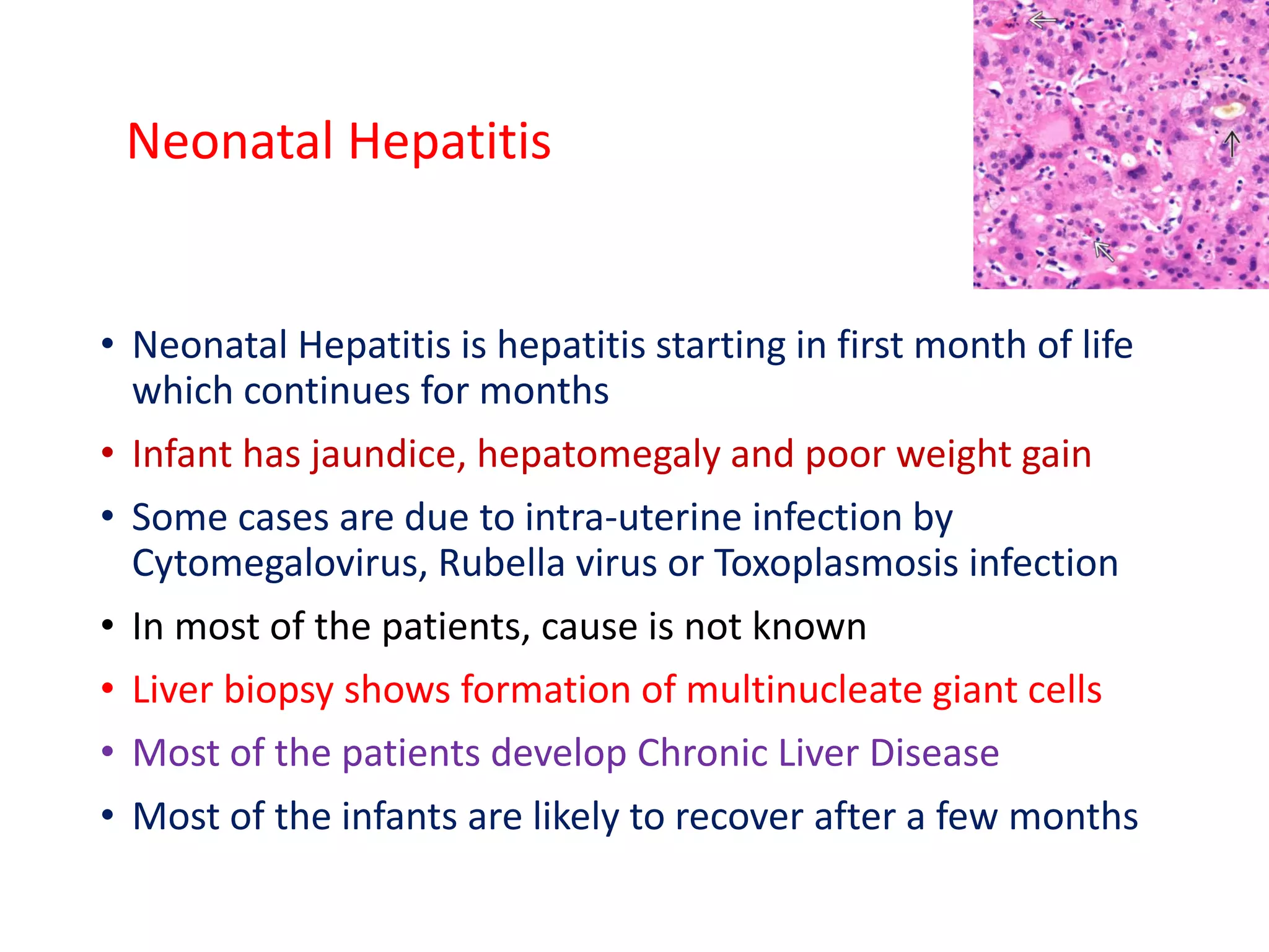 Chronic liver disease in children 2021 | PDF