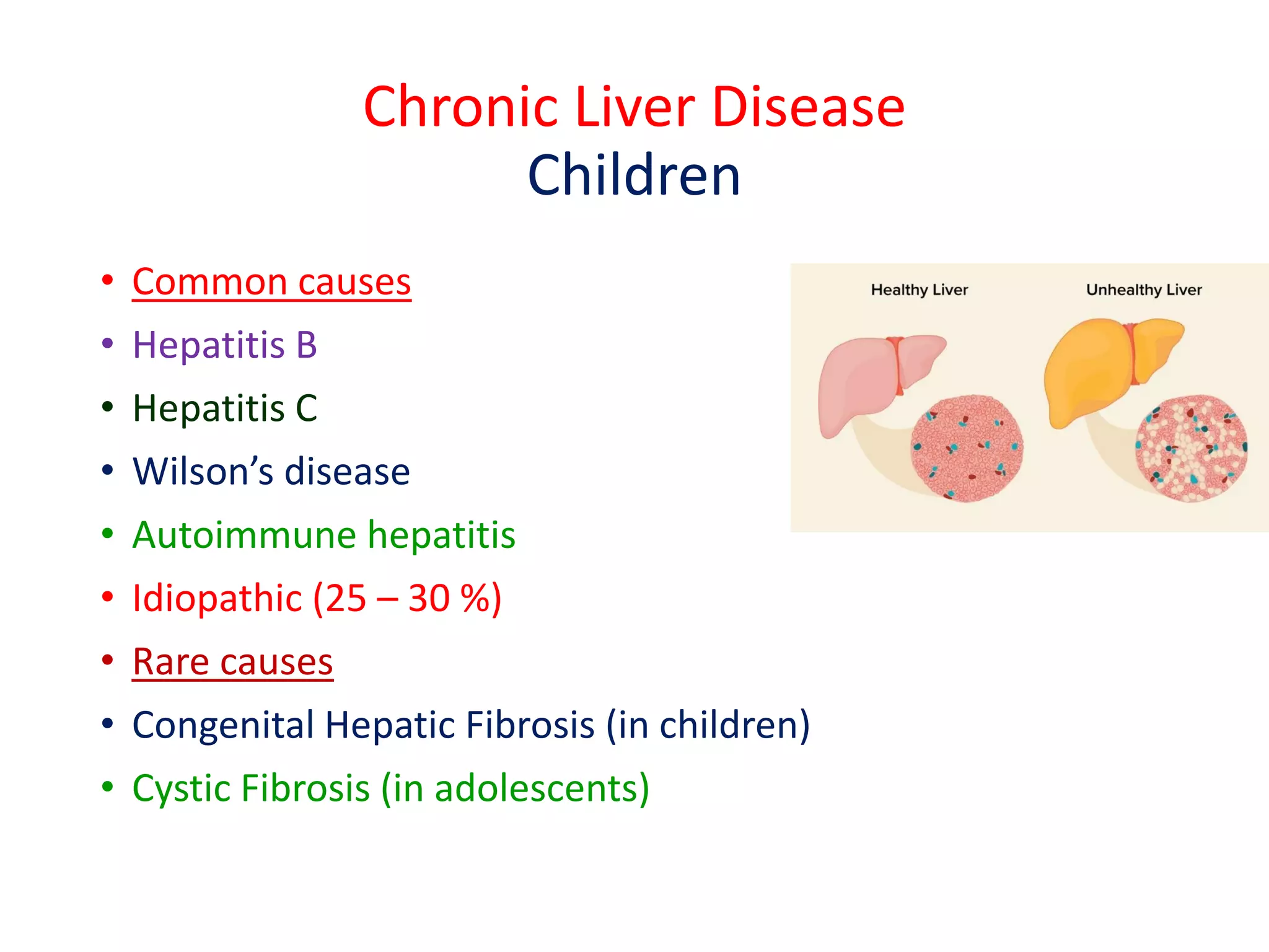 Chronic liver disease in children 2021 | PDF