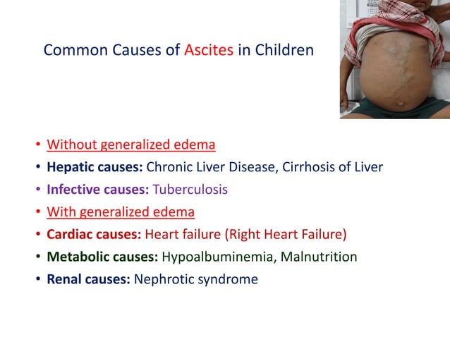 Chronic liver disease in children 2021 | PDF