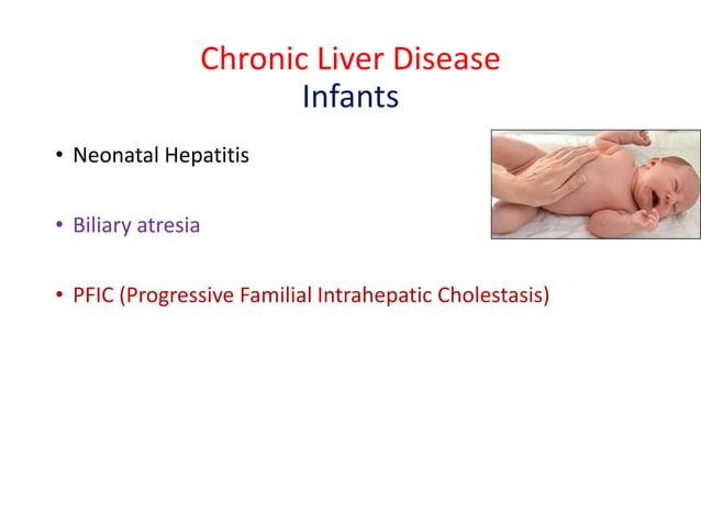 Chronic liver disease in children 2021 | PDF