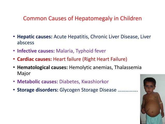 Chronic liver disease in children 2021 | PDF