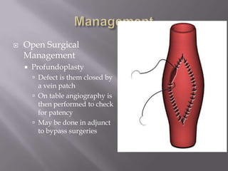 Chronic lower limb ischemia | PPT