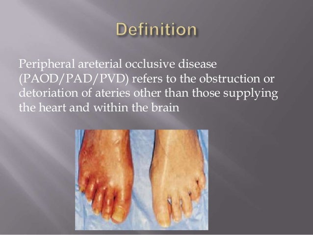 Chronic lower limb ischemia