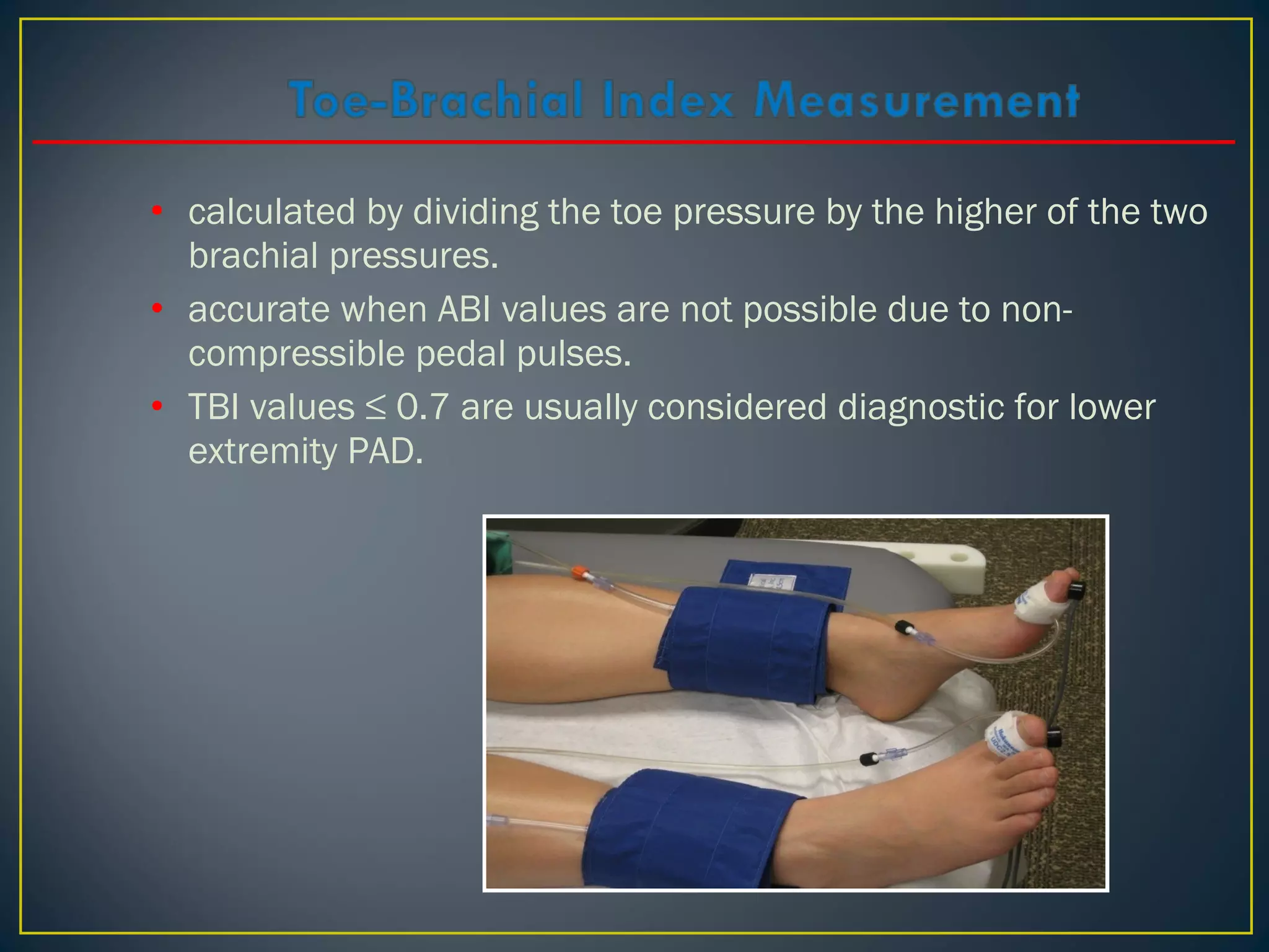 Chronic lower limb ischemia | PPT