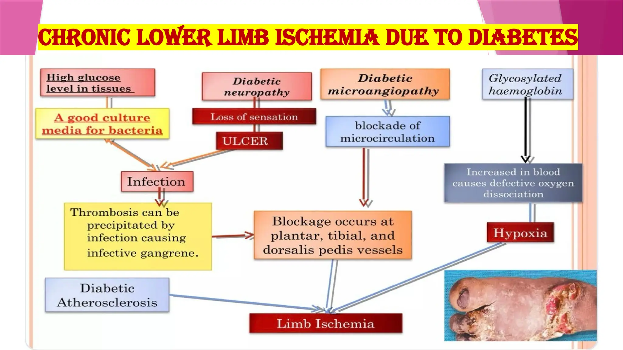 CHRONIC LOWER LIMB ISCHEMIA new.pptxTypes , clinical features | PPT