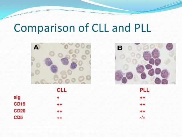 Chronic lymphocytic leukemia