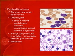 Chronic lymphocytic leukemia | PPTX