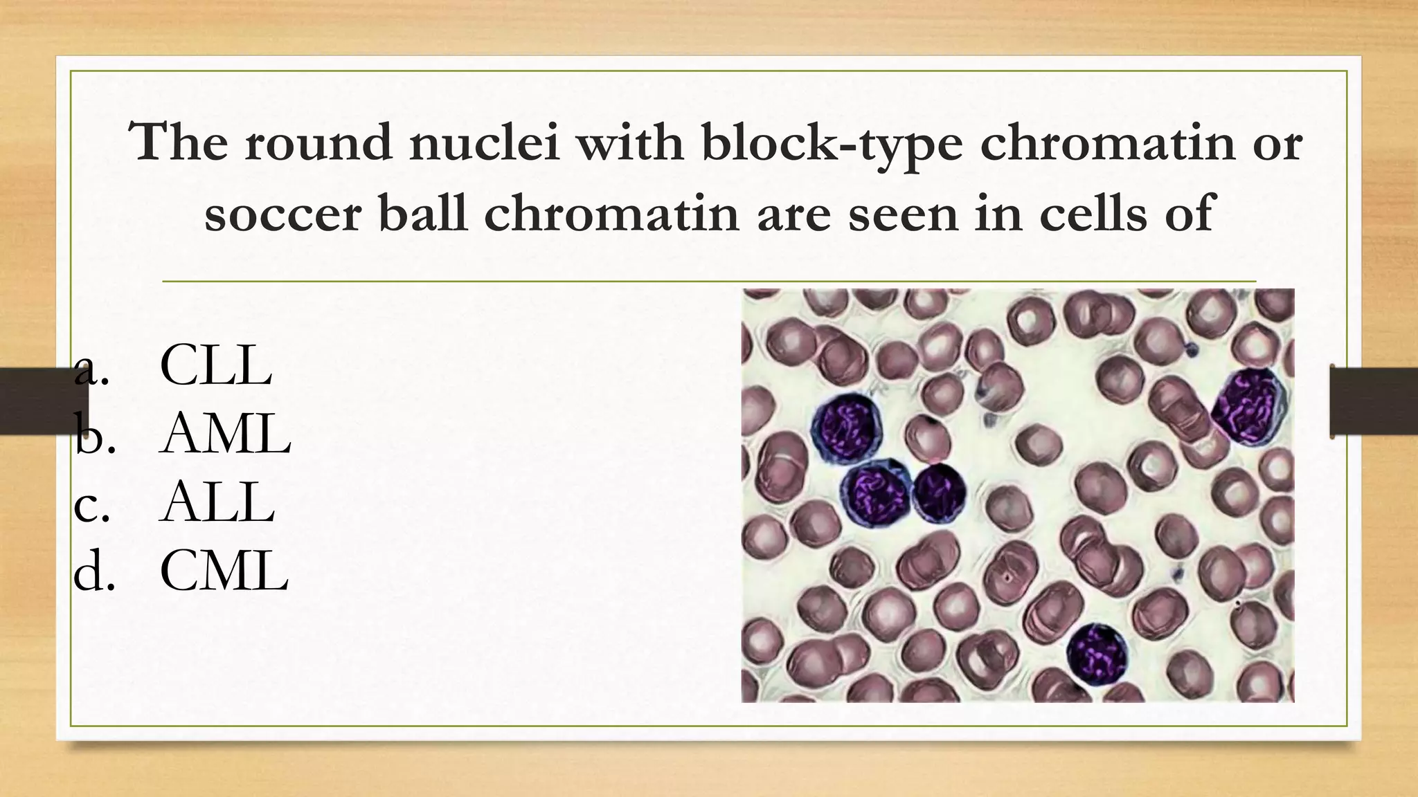 Chronic Lymphocytic Leukemia (CLL) | PPTX