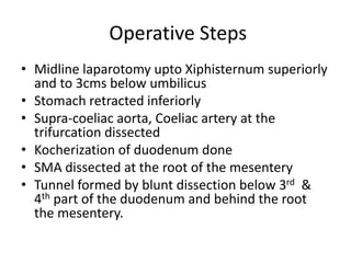 Chronic mesesnteric ischaemia | PPTX