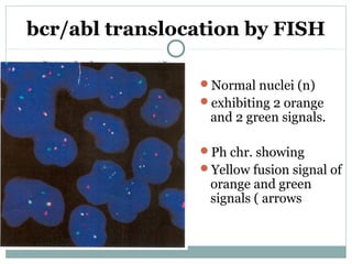 Chronic Myeloid Leukaemia | PPT | Blood Disorders | Diseases and Conditions