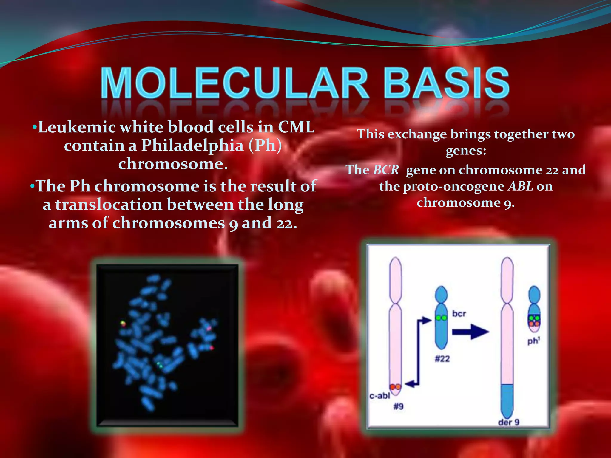 Chronic Myeloid Leukemia | PPTX