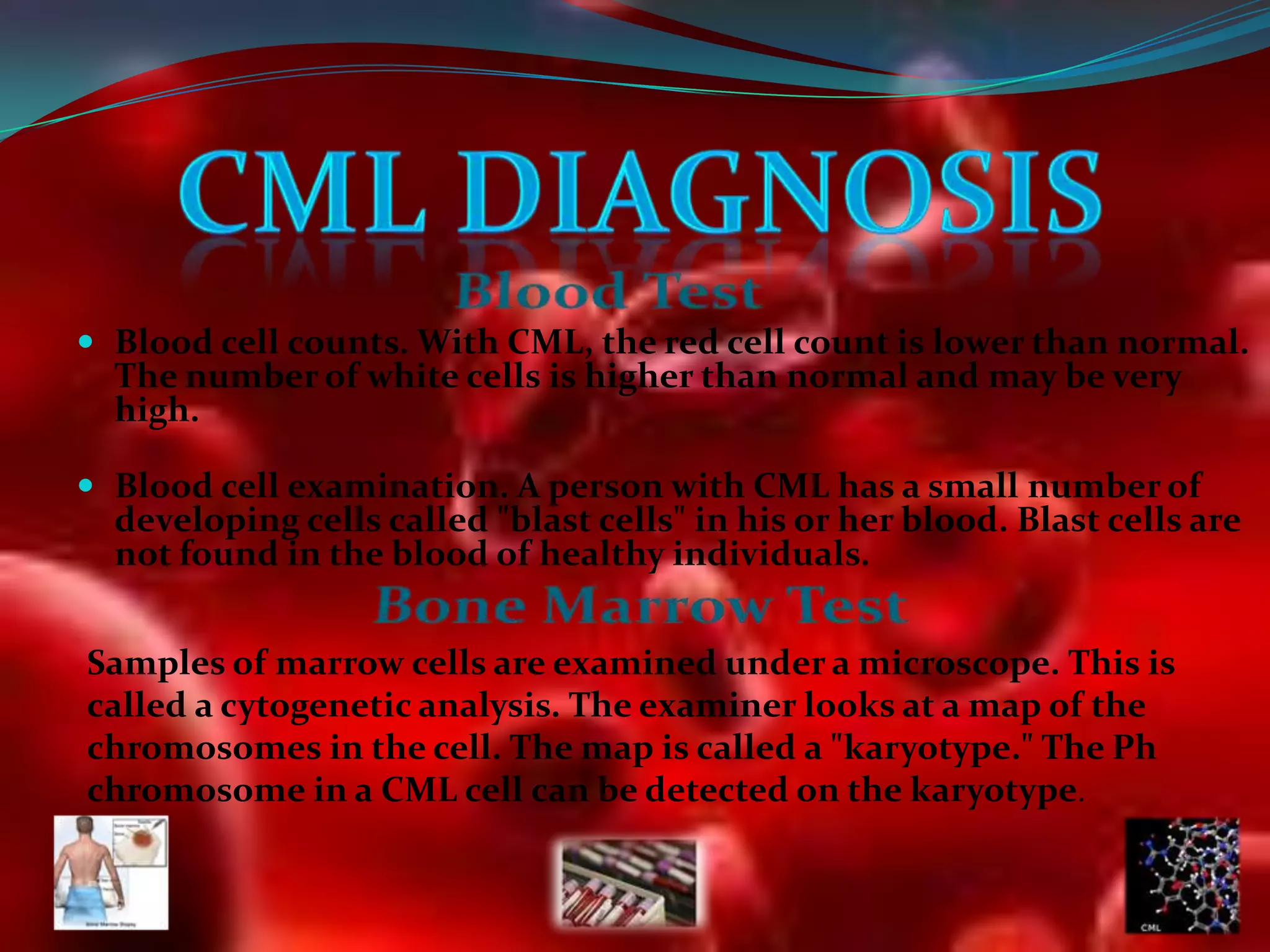Chronic Myeloid Leukemia | PPTX