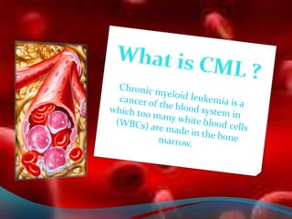 Chronic Myeloid Leukemia | PPTX