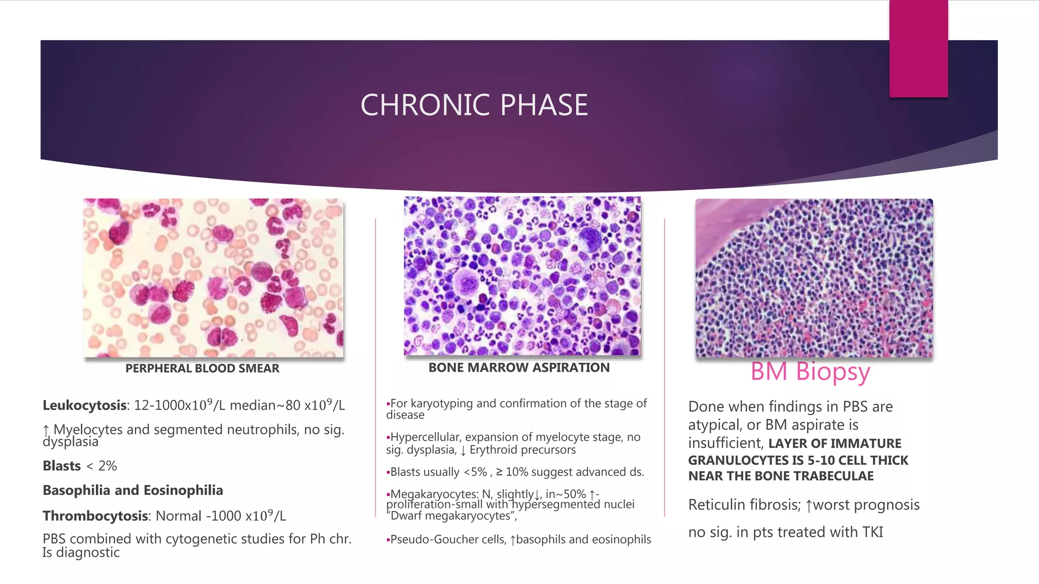 Chronic myeloid leukemia | PPT