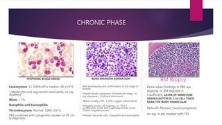Chronic myeloid leukemia | PPTX