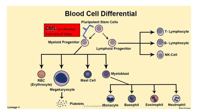 Chronic myeloid leukemia (CML) | PPT