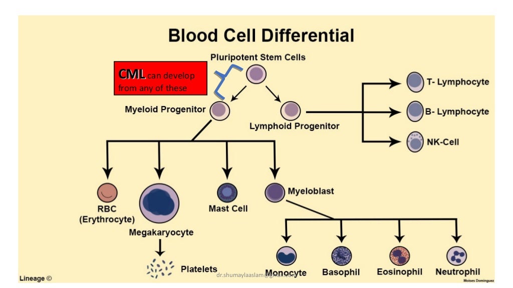 Chronic myeloid leukemia (CML)