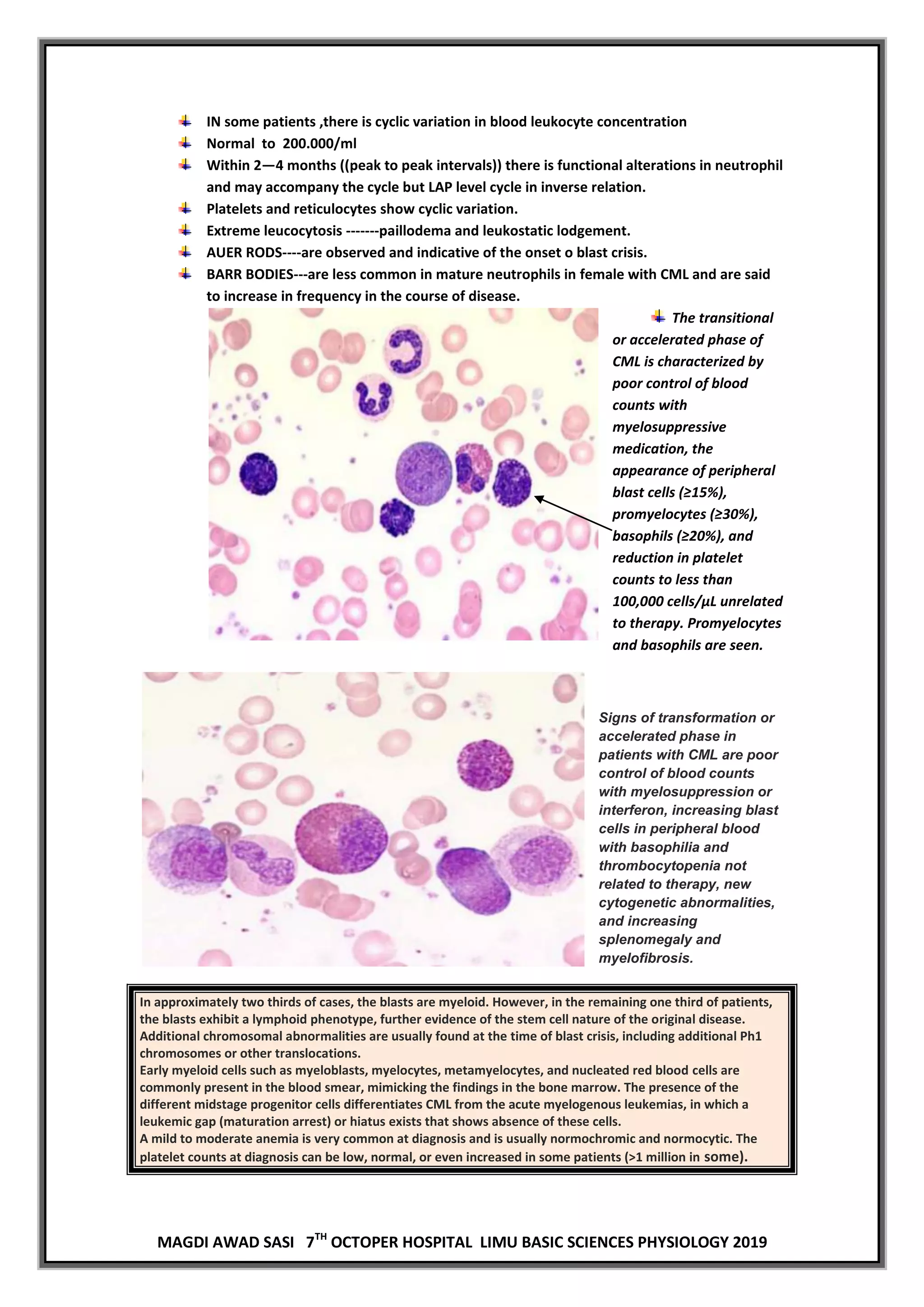 Chronic myeloid leukemia magdi sasi 2019 ramadan | PDF