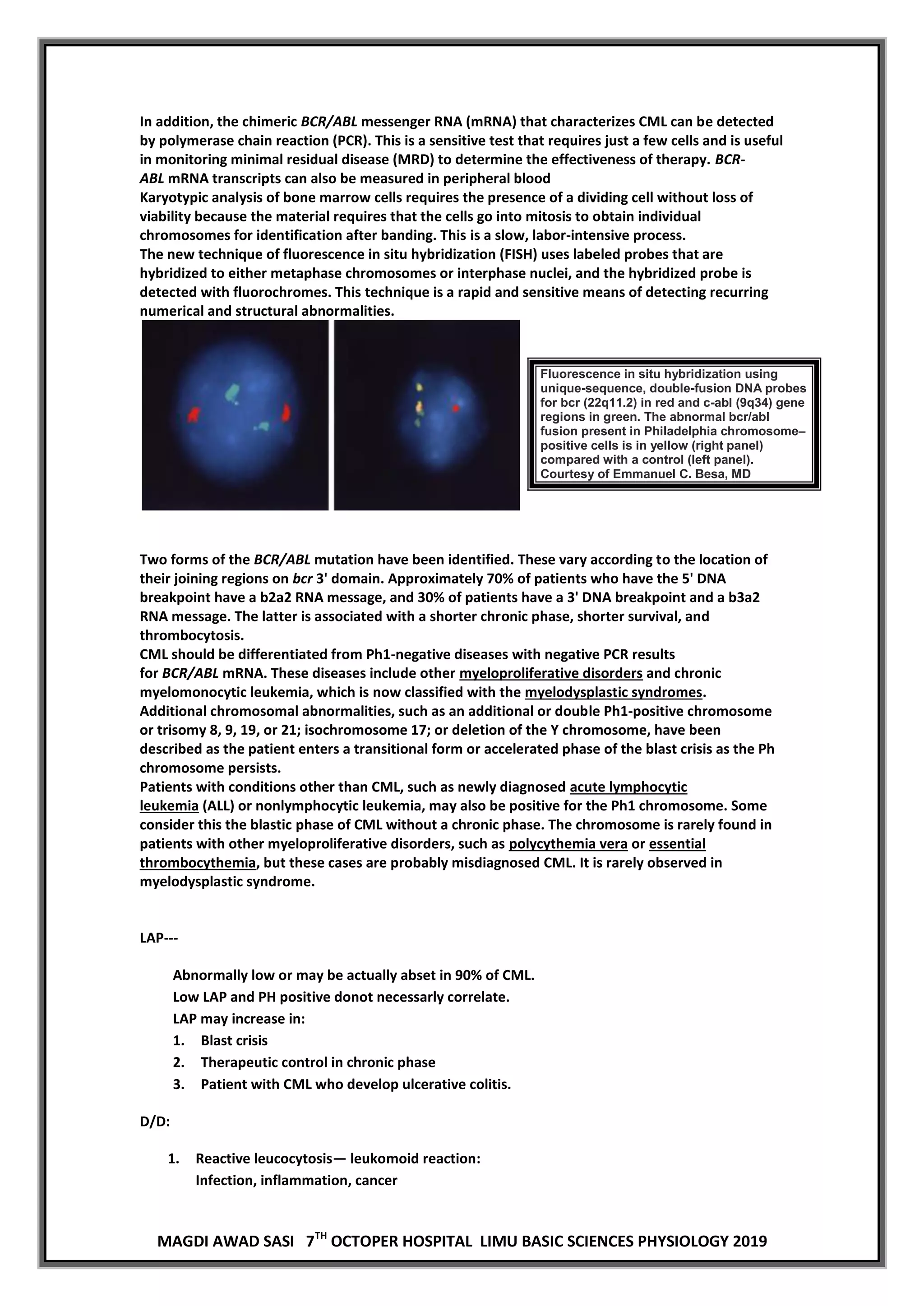 Chronic myeloid leukemia magdi sasi 2019 ramadan | PDF