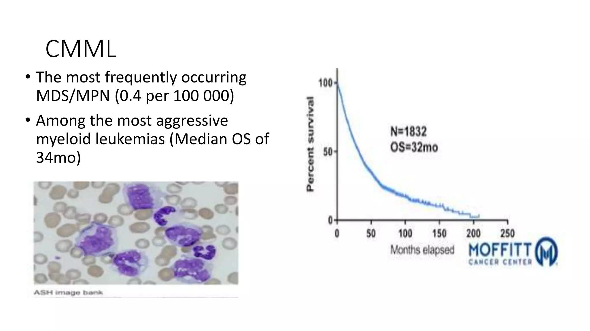 CHRONIC MYELOMONOCYTIC LEUKEMIA.pptx