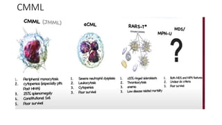 CHRONIC MYELOMONOCYTIC LEUKEMIA.pptx