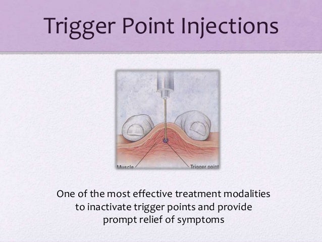 Chronic myofascial pain