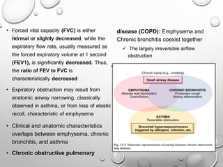 Chronic Obstructive Airway diseases | PPTX