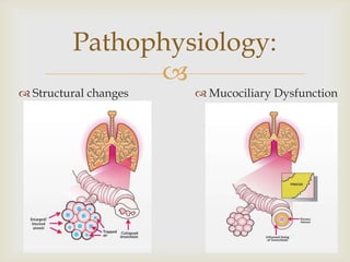 Chronic obstructive airway disease (coad) | PPTX