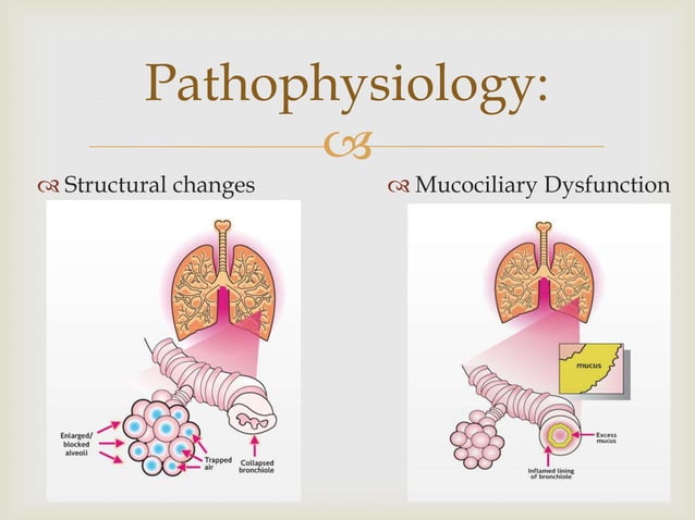 Chronic obstructive airway disease (coad) | PPTX